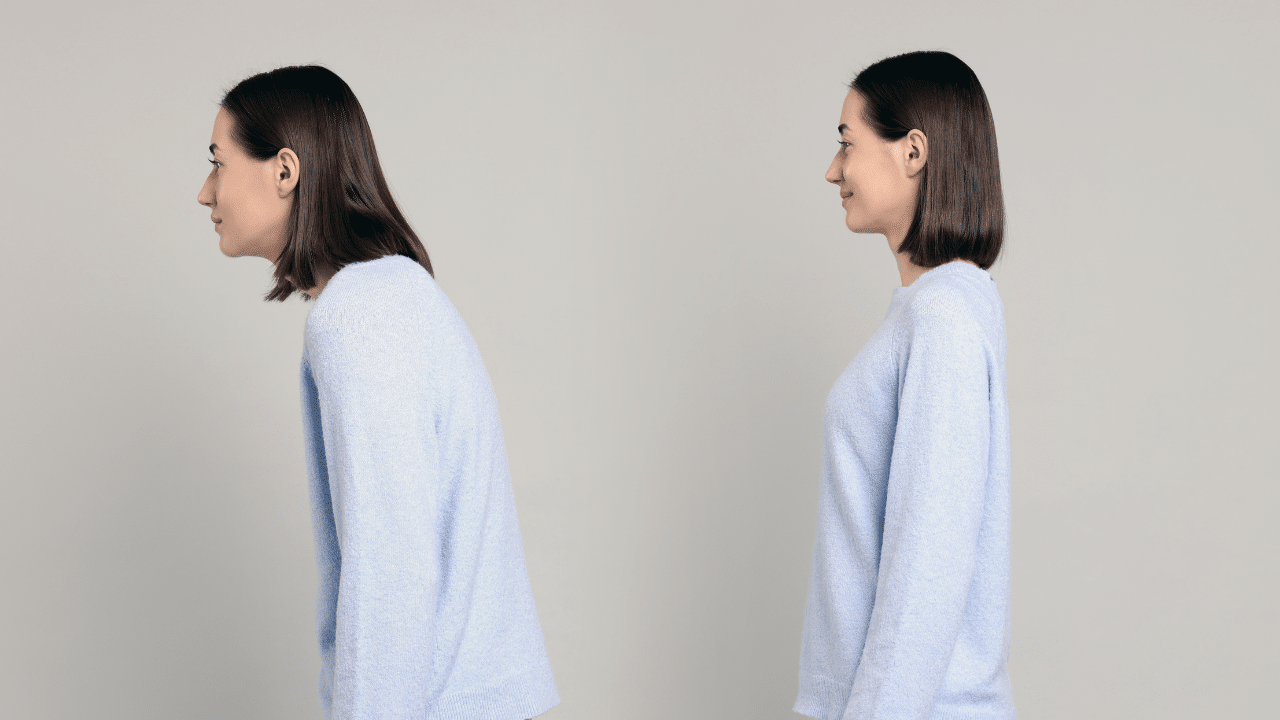 Shoulder Blade Pain and Postural Syndrome | ME PT